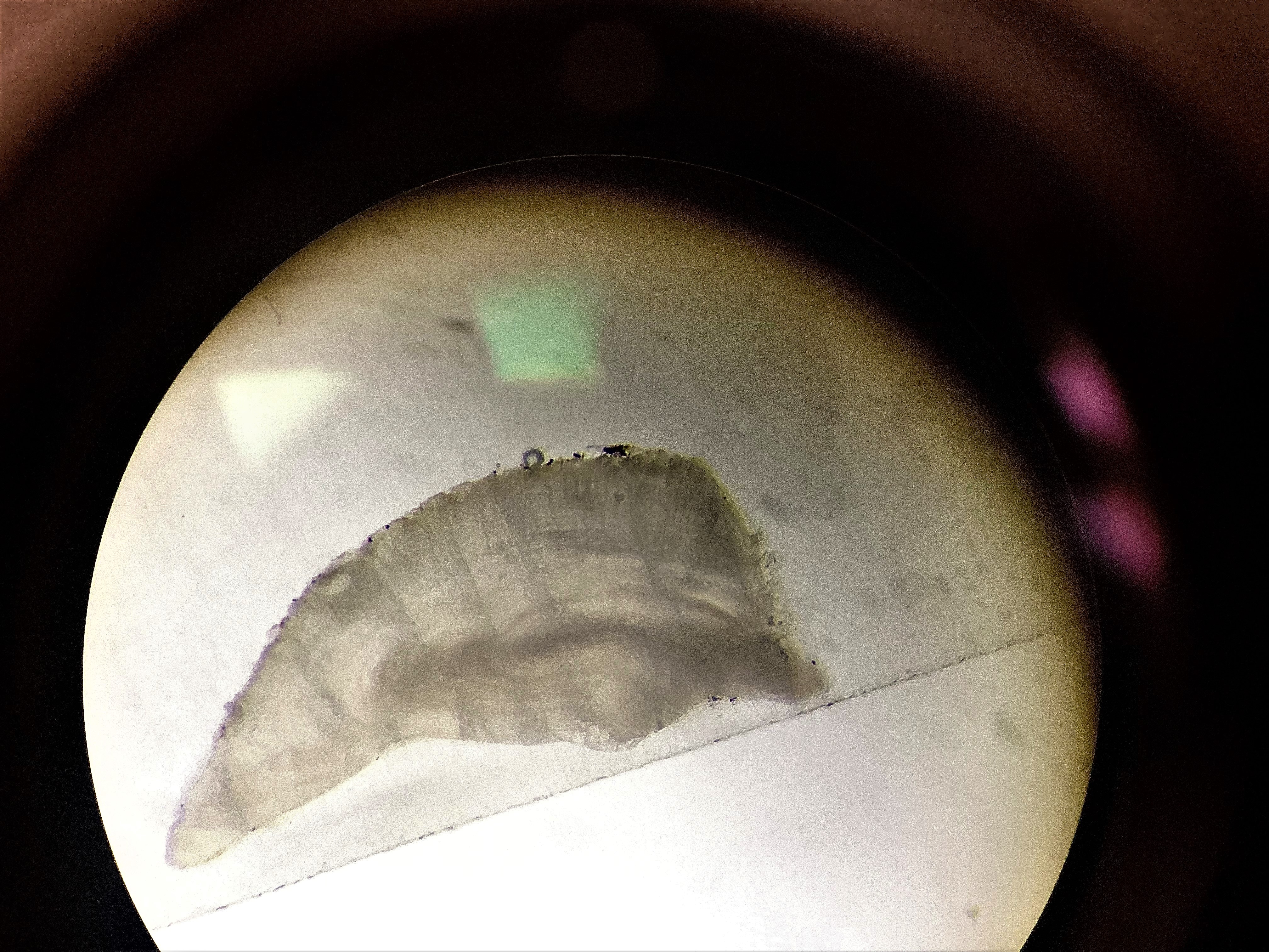 invasive carp otolith | FWS.gov