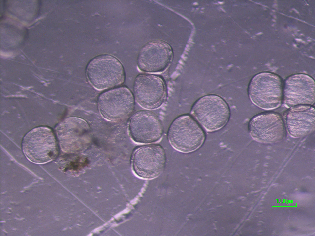 Glochidia of the golden riffleshell | FWS.gov